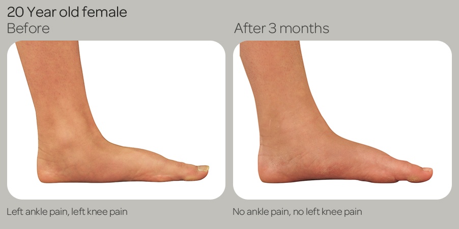 Foot Posture Centre: Natural Corrective Podiatry Success Stories