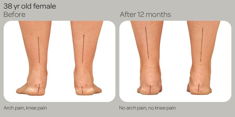 Foot Posture Centre: Natural Corrective Podiatry Success Stories