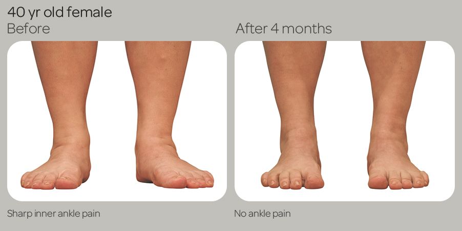 Foot Posture Centre: Natural Corrective Podiatry Success Stories