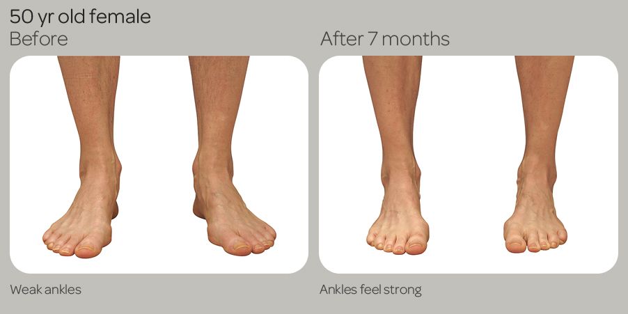 Foot Posture Centre: Natural Corrective Podiatry Success Stories